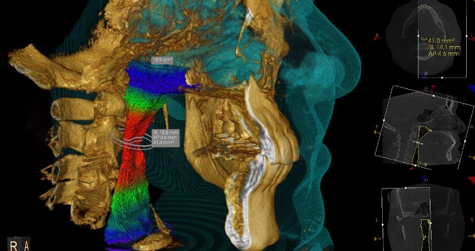 3D DANTŲ TYRIMAI (CBCT IR RENTGENAS) | KOOC klinika - šypsenų kūrėjai